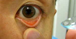 A Guide For Your First Time Wearing Contact Lenses - Contacts Advice